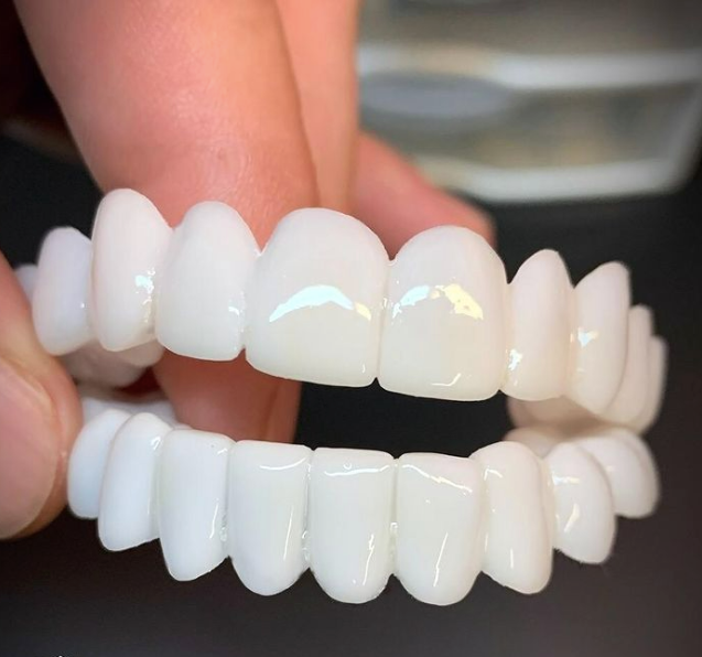 PerfectSmile™️ Snap-on teeth (upper + lower kit) – Shoplari